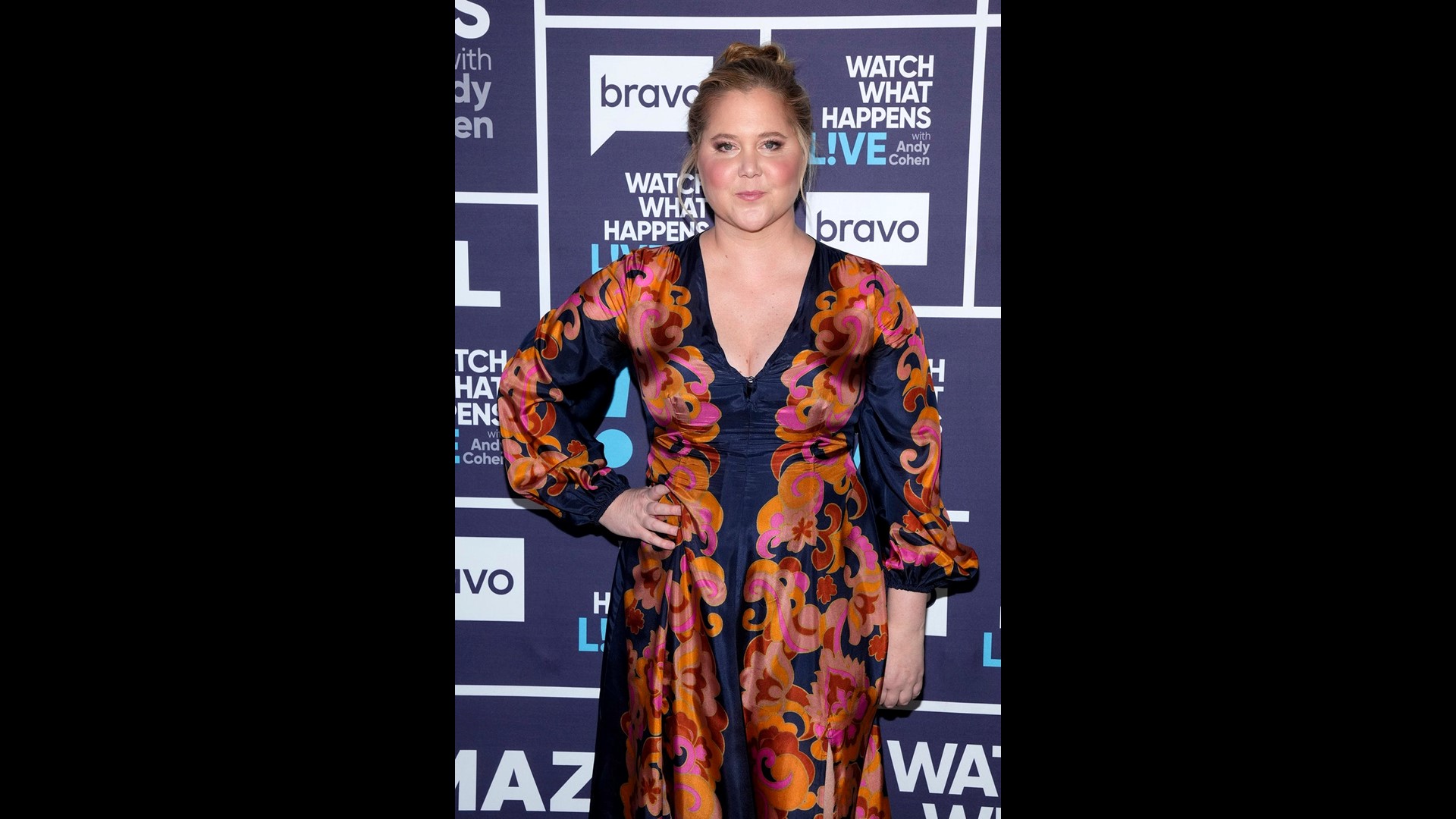 Amy Schumer Credits 'Puffier' Face Comments With Alerting Her to ...
