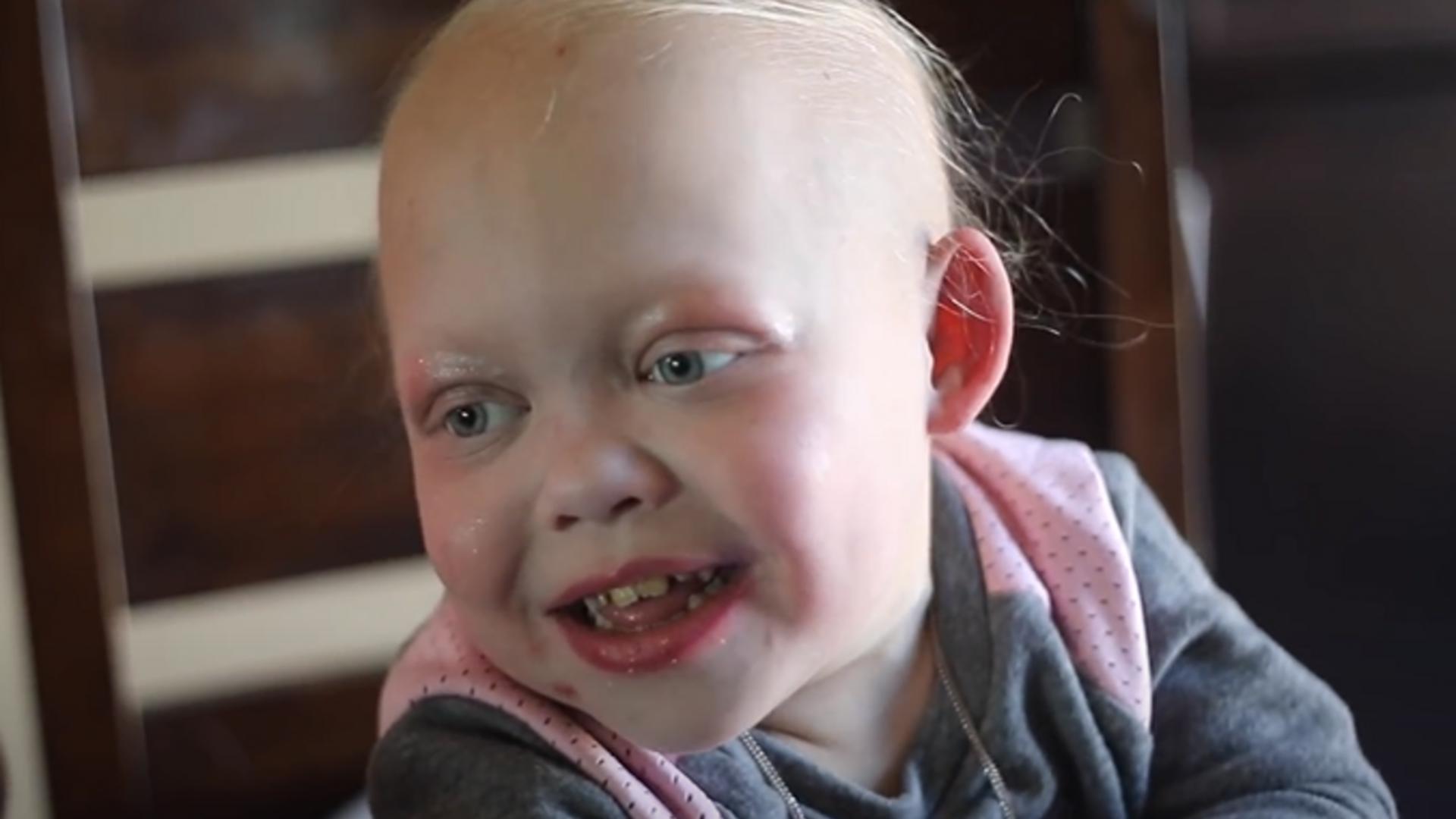 10-Year-Old TikToker Bella Brave Placed in Medically Induced Coma ...