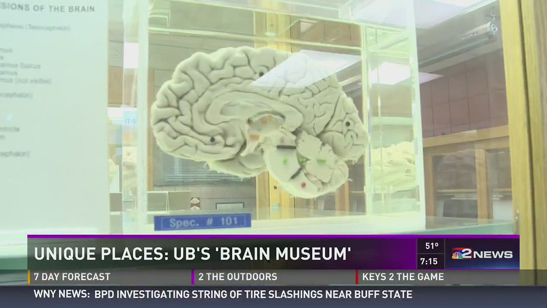 Unique Places: Buffalo's Brain Museum | wgrz.com