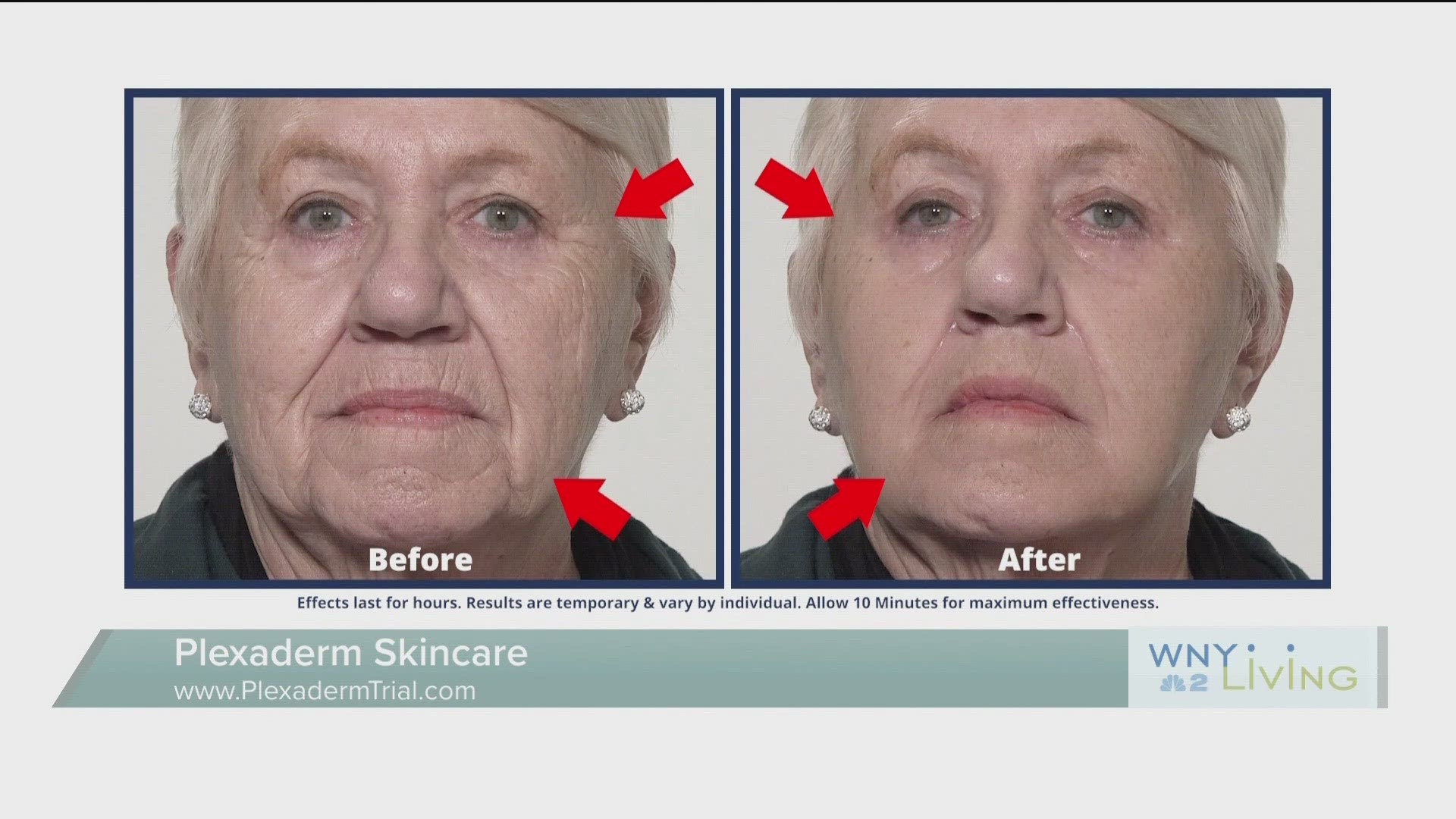 October 7 - Plexaderm Skincare | wgrz.com