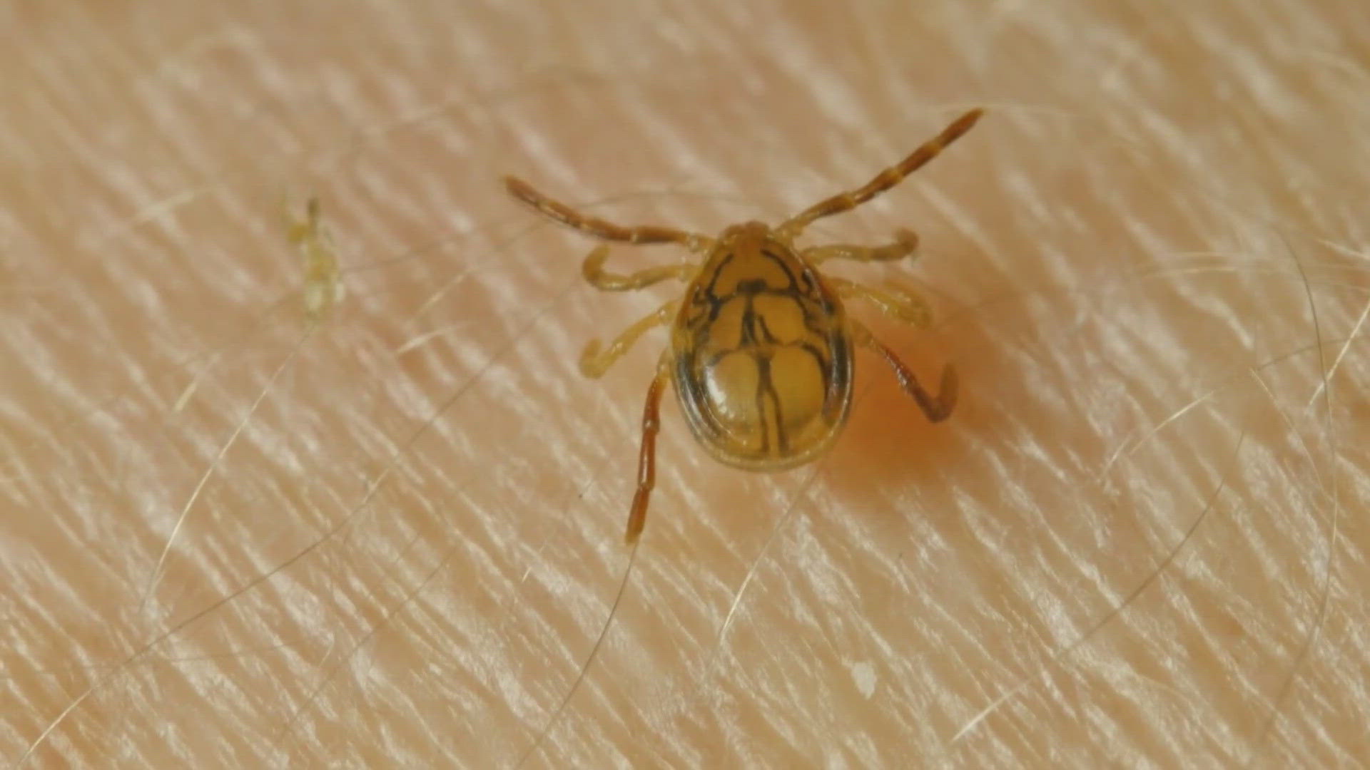 Western New York sees spike in tick-related fears | wgrz.com