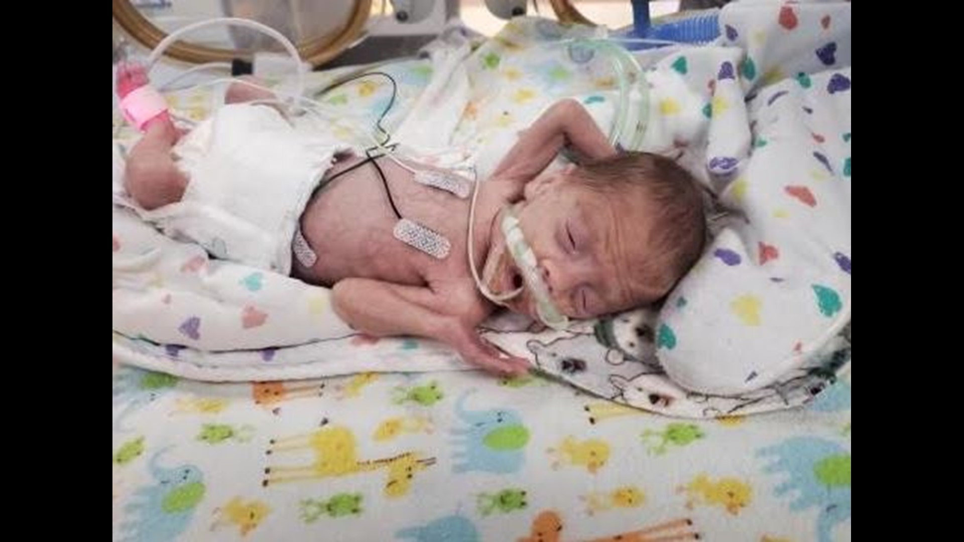 The little engine that could: Knox Thieroff's fight for survival | wgrz.com