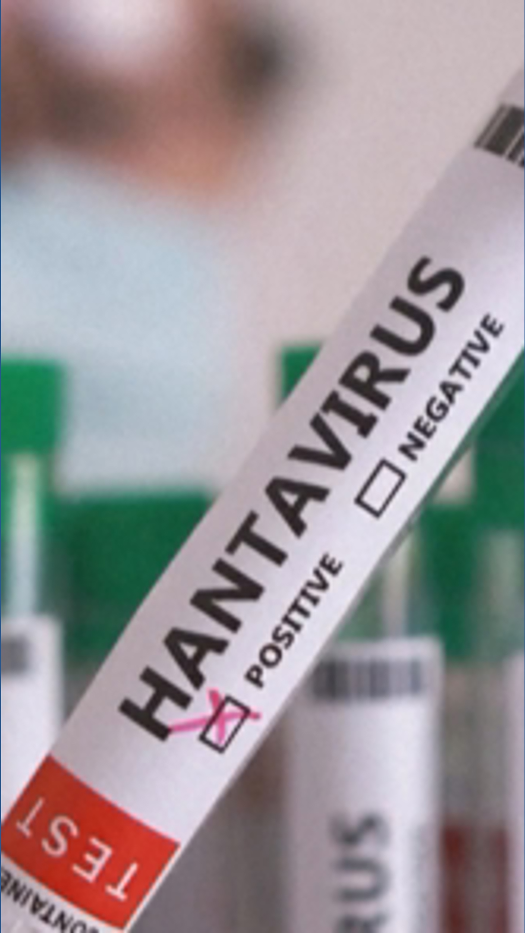 Doctor from UB Jacobs School explains hantavirus | wgrz.com