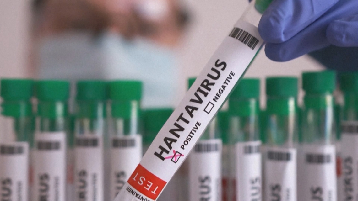 Doctor from UB Jacobs School explains hantavirus | wgrz.com