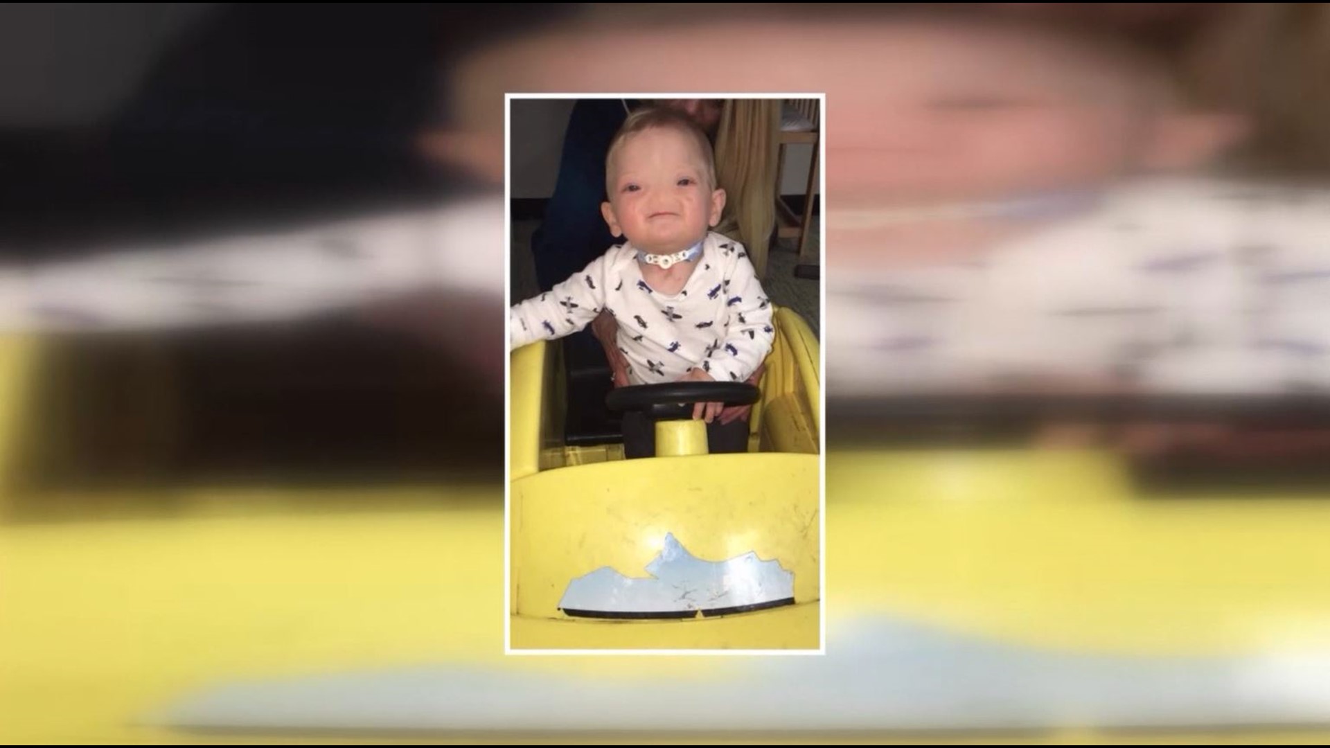 Eli Thompson, 'miracle baby' born without nose, dies at 2-years-old ...